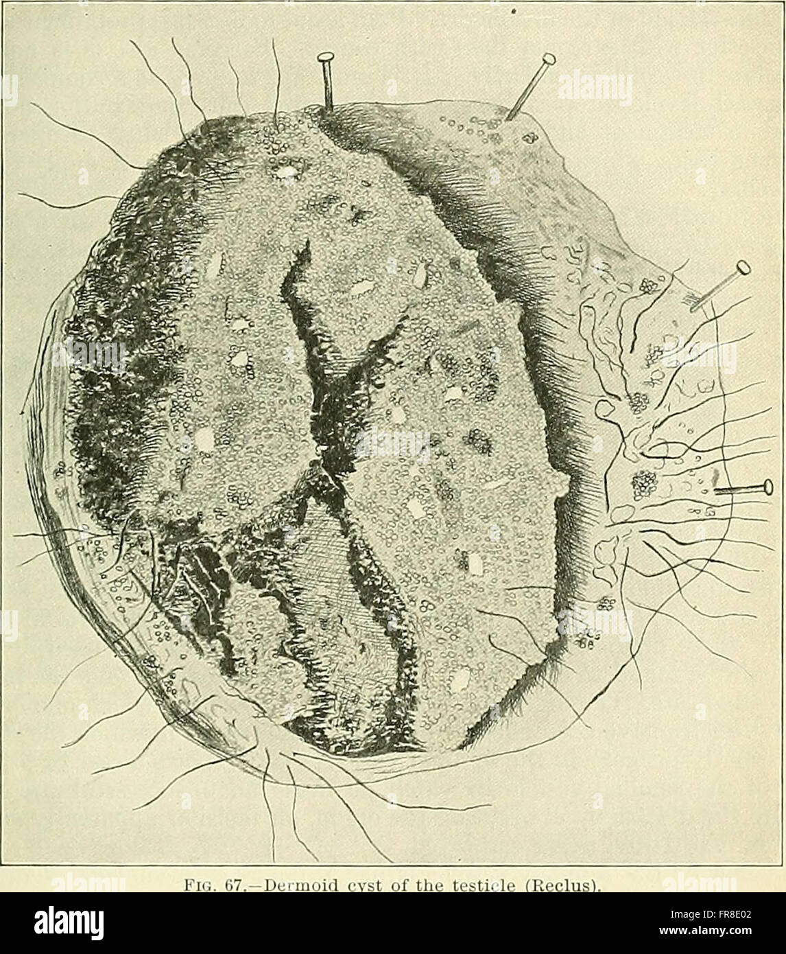 This 1898 textbook provides detailed information on genito-urinary ...