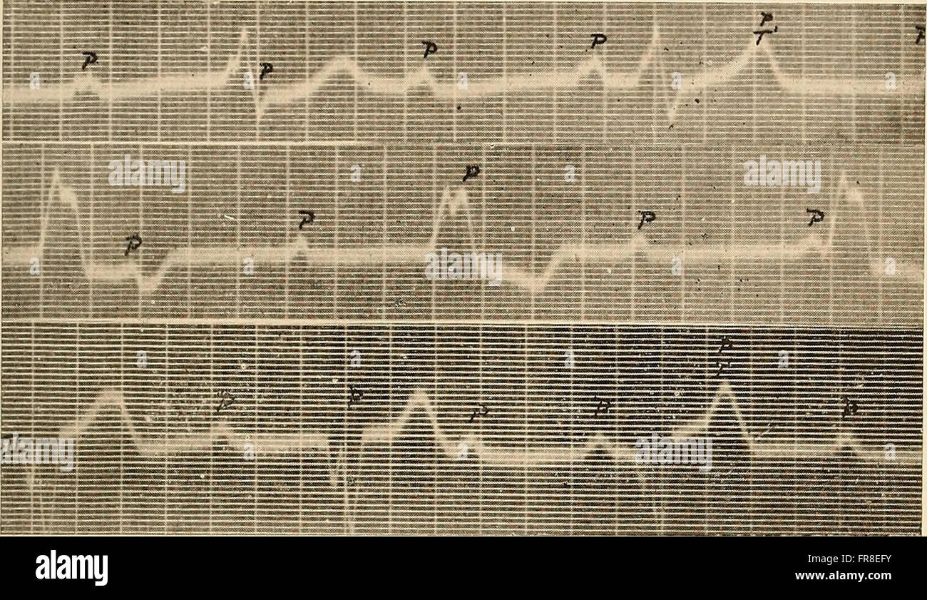 *Clinical Electrocardiography* (1922) covers the principles and ...