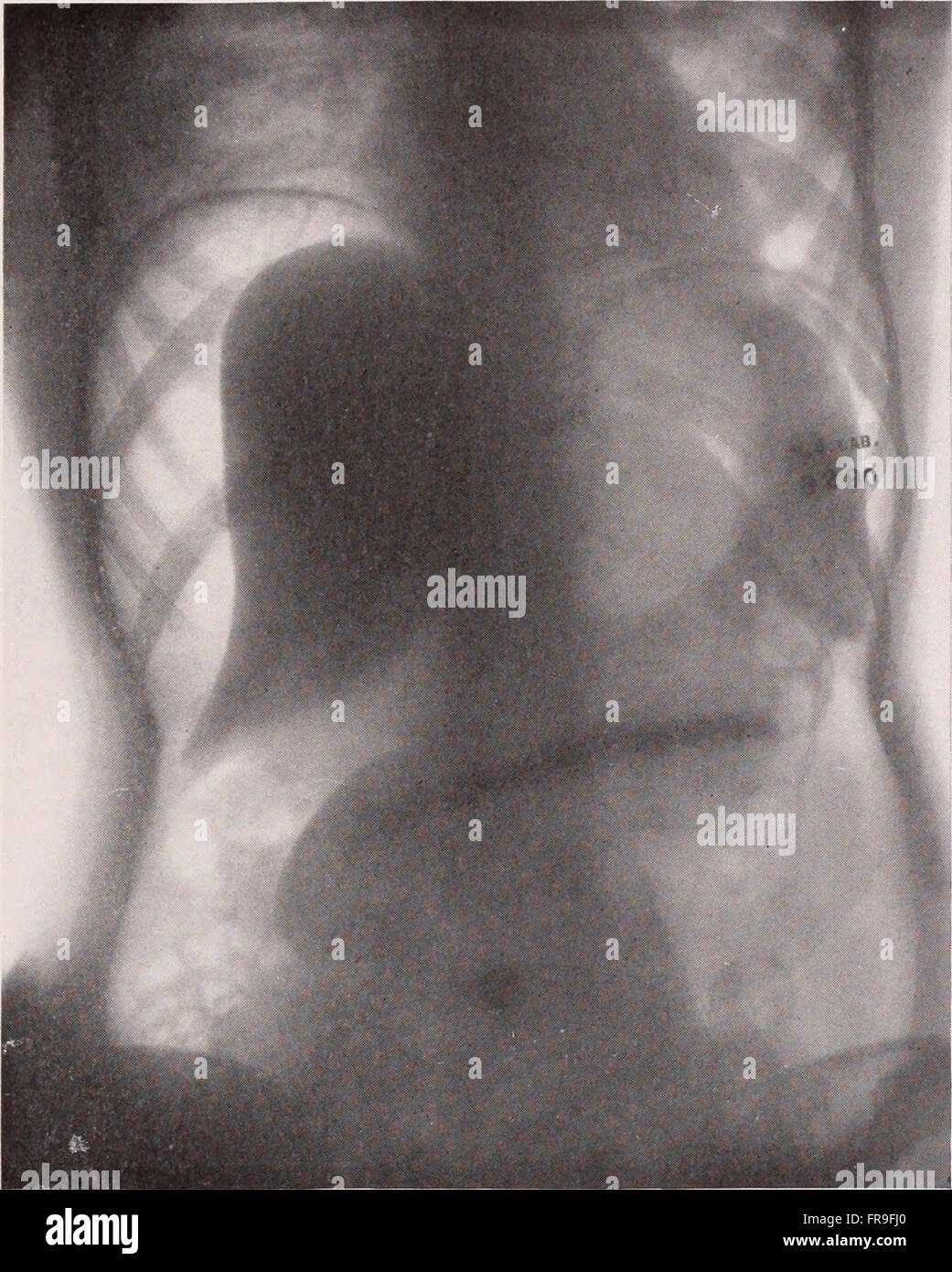 The 1919 Journal of Roentgenology publishes research on X-rays and ...