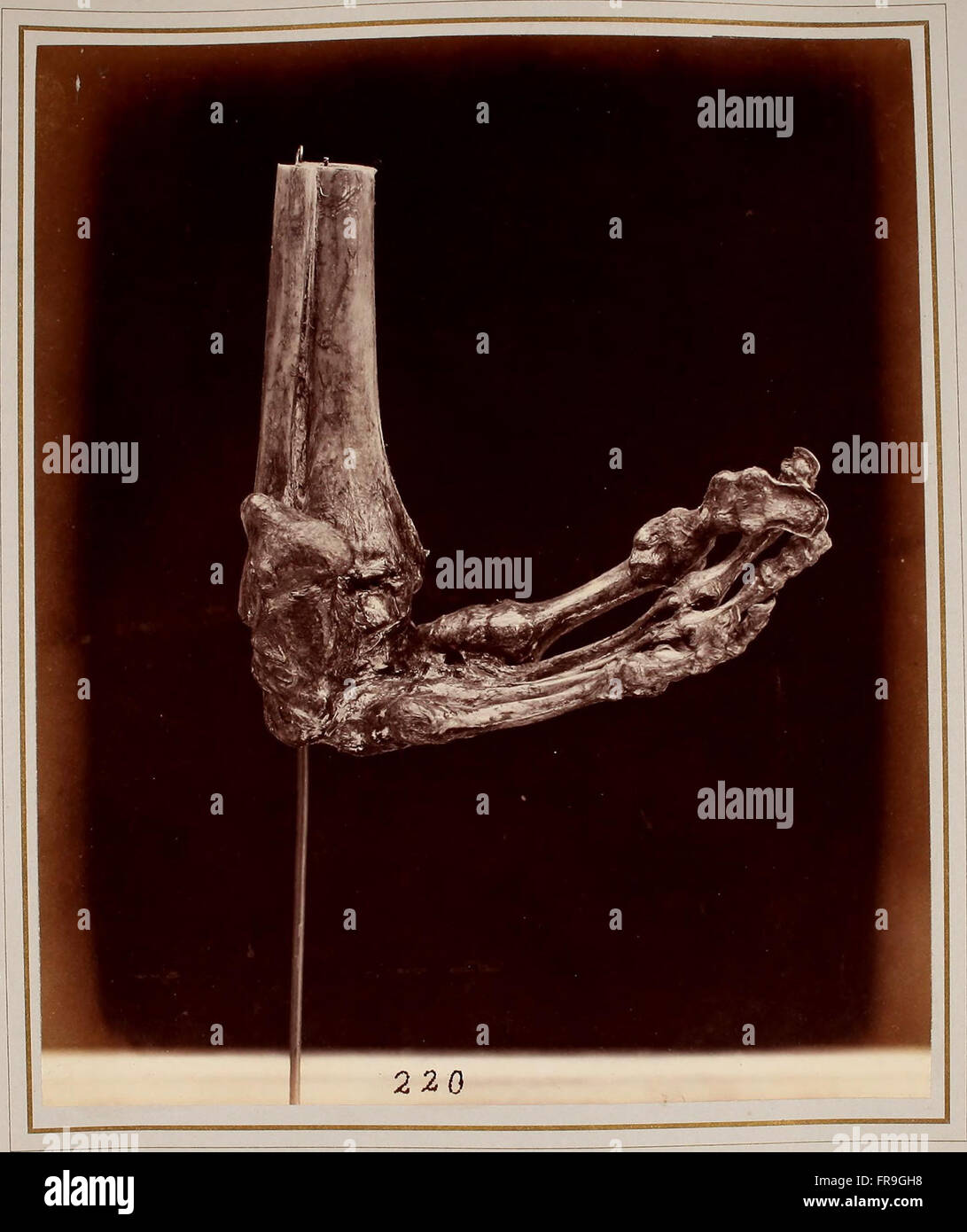 This 1865 work showcases photographs of various surgical cases and ...
