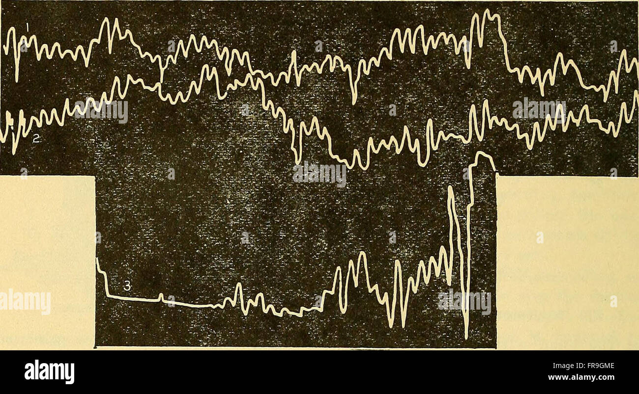 Man Abnormal Man Including Study High Resolution Stock Photography and ...