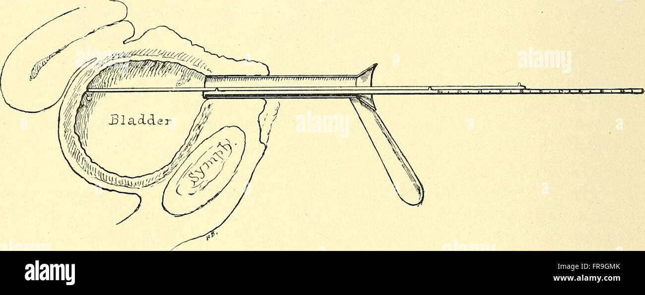 Operative gynecology - (1906 Stock Photo - Alamy