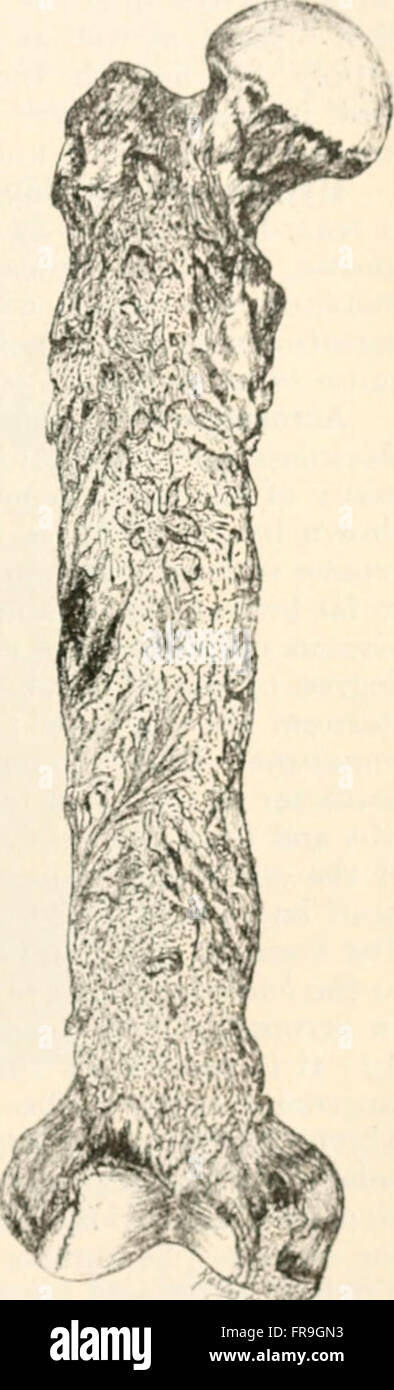 Manual of pathology - including bacteriology, the technic of ...