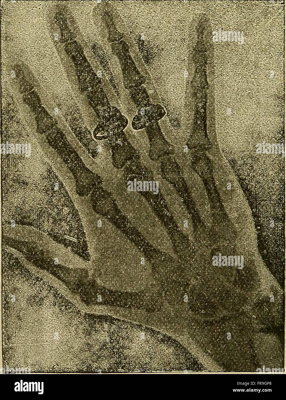 A 1900 manual on radiography and radiology, focusing on the use of X ...