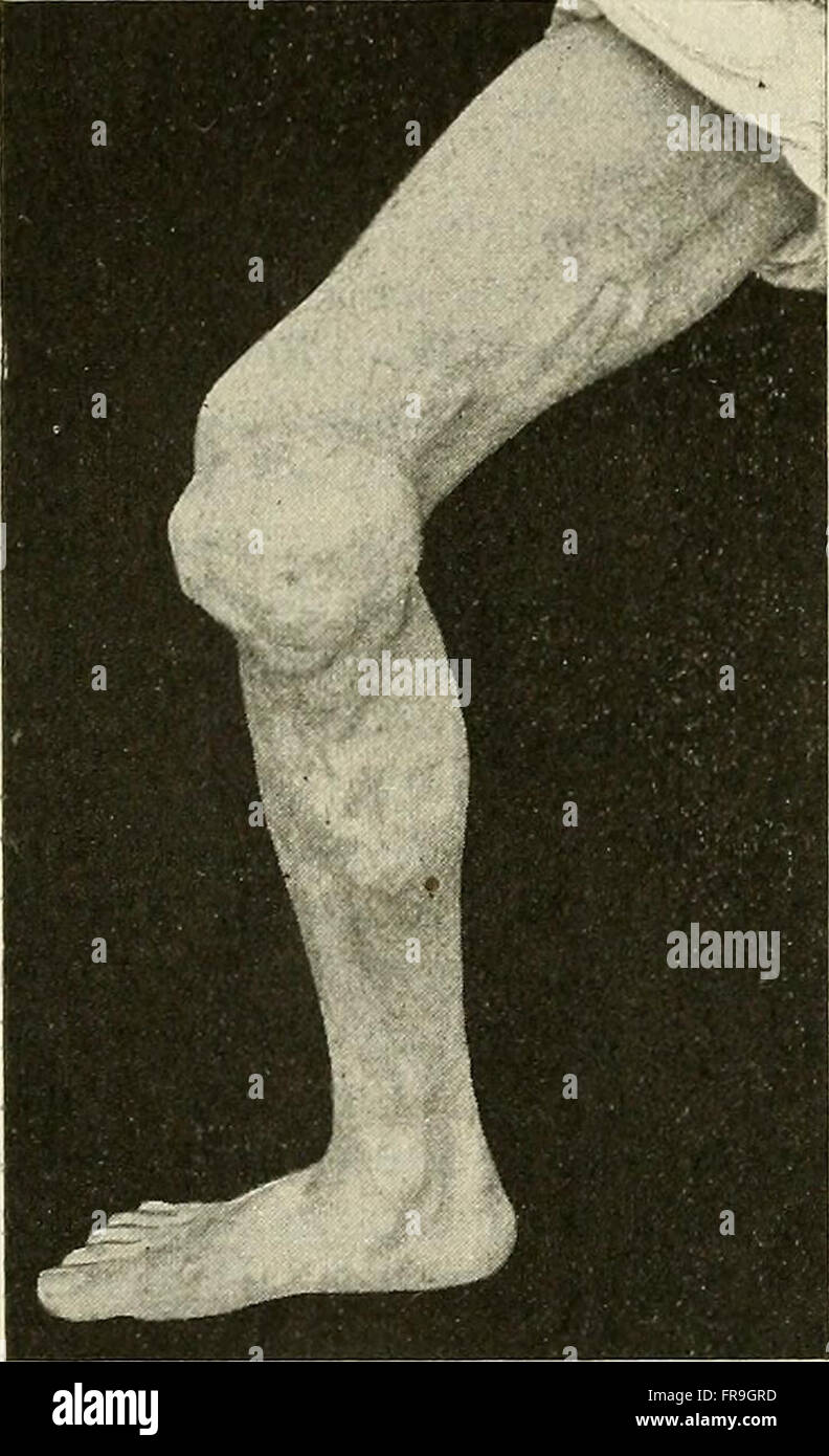 Modern surgery, general and operative (1914 Stock Photo - Alamy