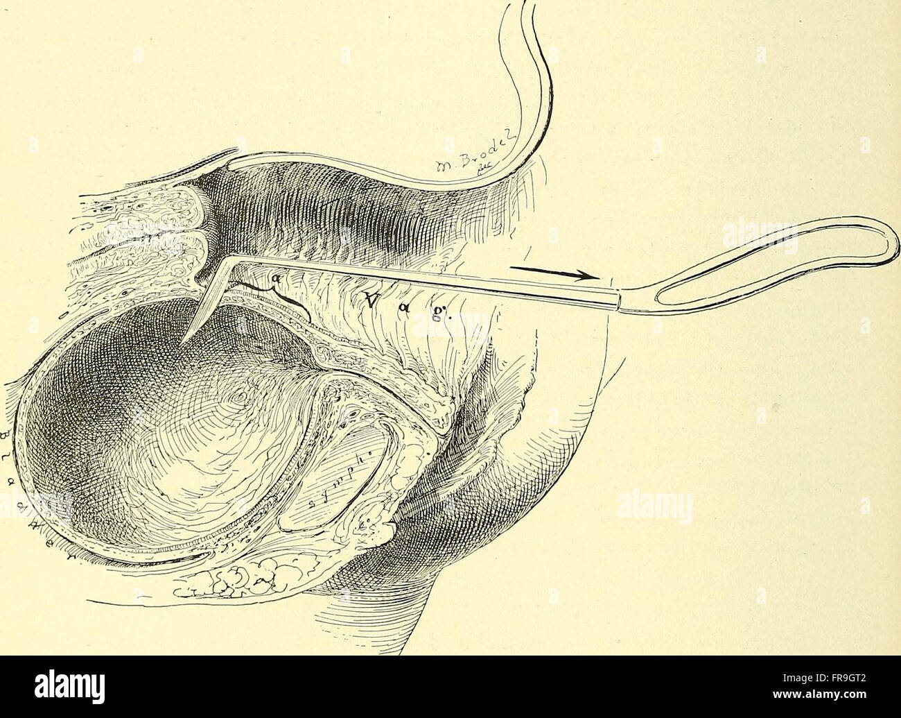 A medical text from 1906 focusing on operative gynecology, covering ...