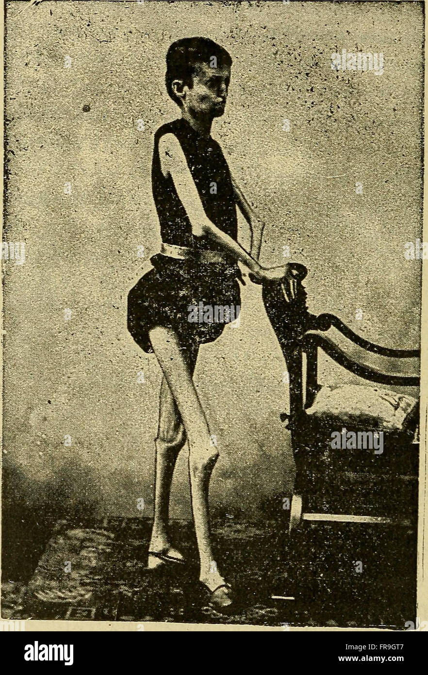 This 1900 French manual discusses the use of X-rays in radiography and ...