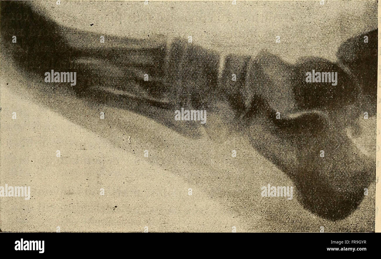 A 1900 manual on radiology and radiography, explaining the use of X ...