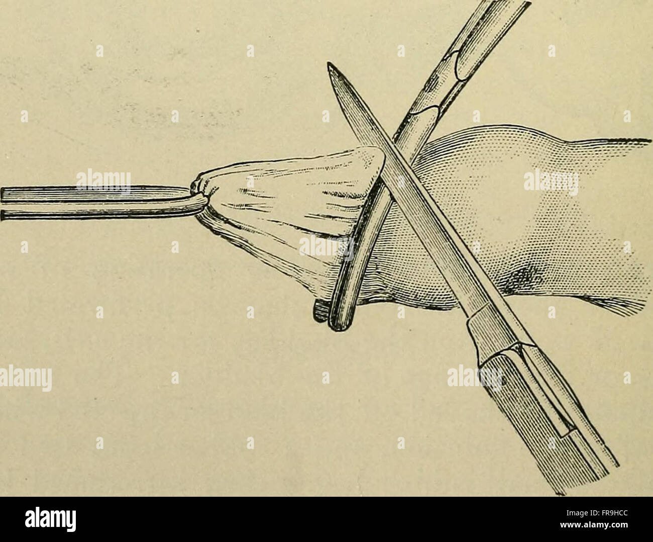 Minor surgery and bandaging; including the treatment of fractures and ...