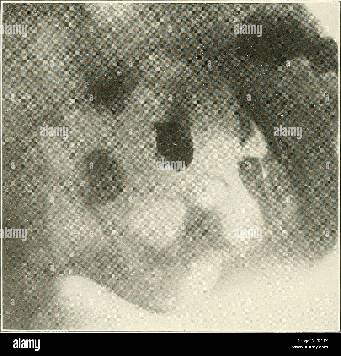 Radiographic interpretation hi-res stock photography and images - Alamy