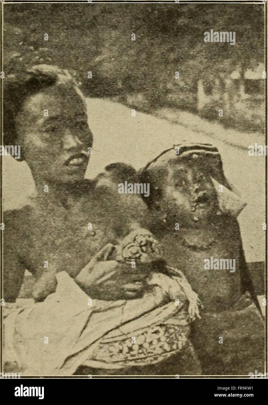 A 1922 medical reference providing diagnostic guidelines and ...