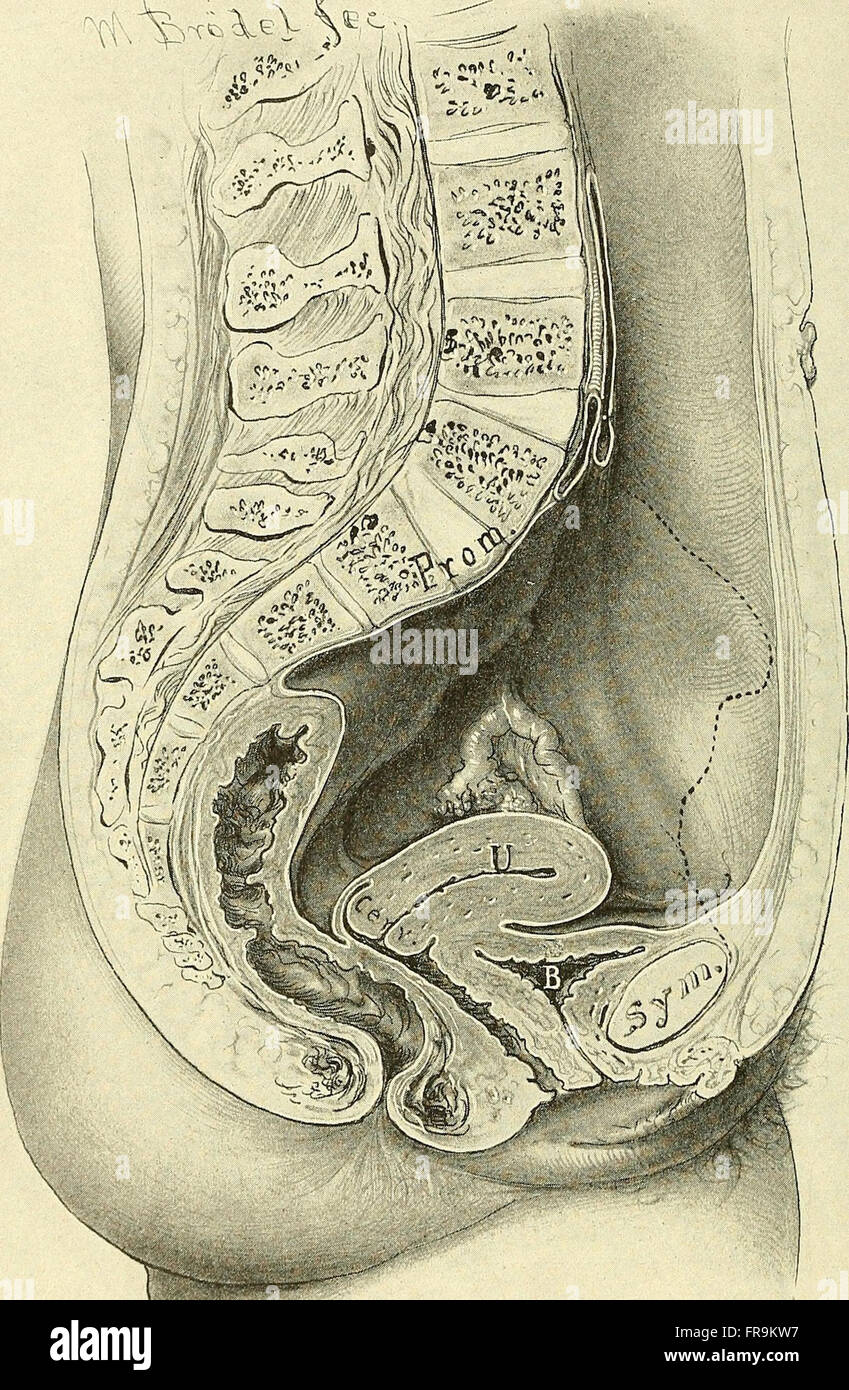 Operative gynecology - (1906 Stock Photo - Alamy