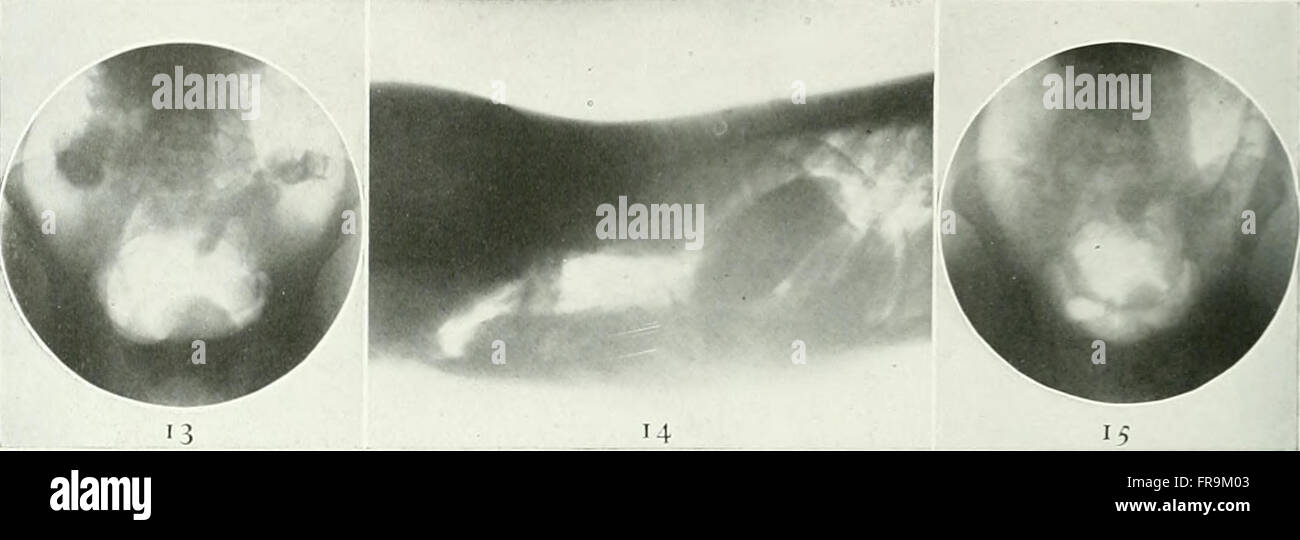 This 1906 journal focuses on the advancements in roentgenology, radium ...