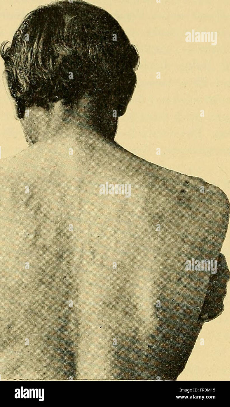 This medical textbook, published in 1906, covers the diseases of the ...