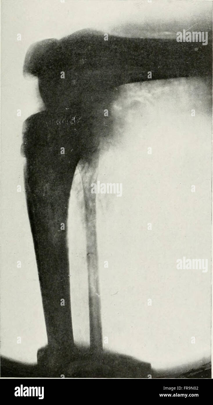 The American journal of roentgenology, radium therapy and nuclear ...