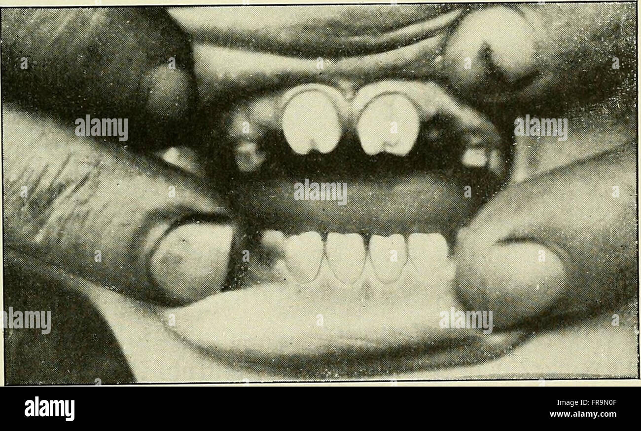 This 1907 work focuses on the study and diagnosis of hereditary ...