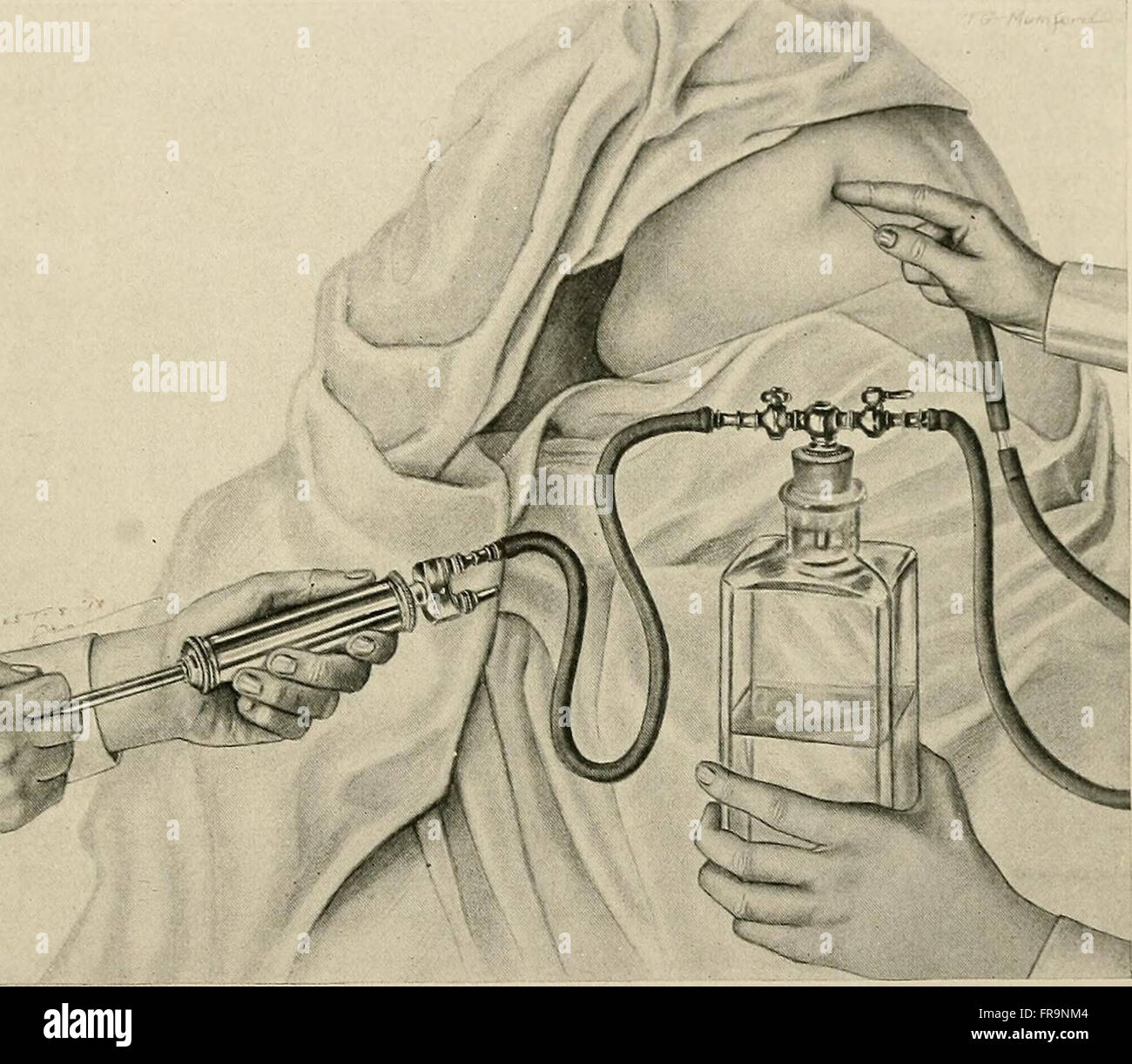 A detailed guide on surgical practices from 1910, outlining various ...