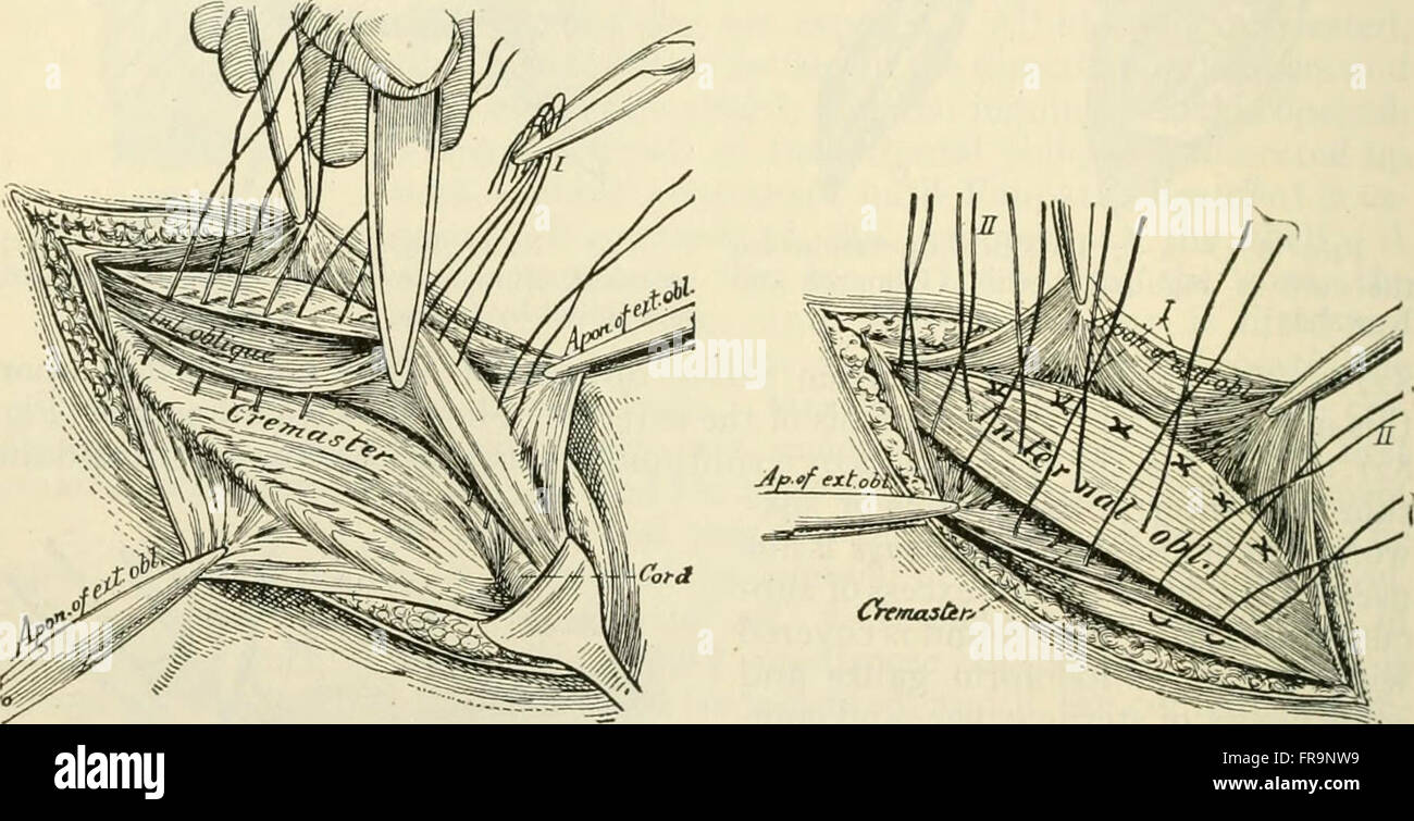*Modern Surgery, General and Operative* (1919) offers a comprehensive ...