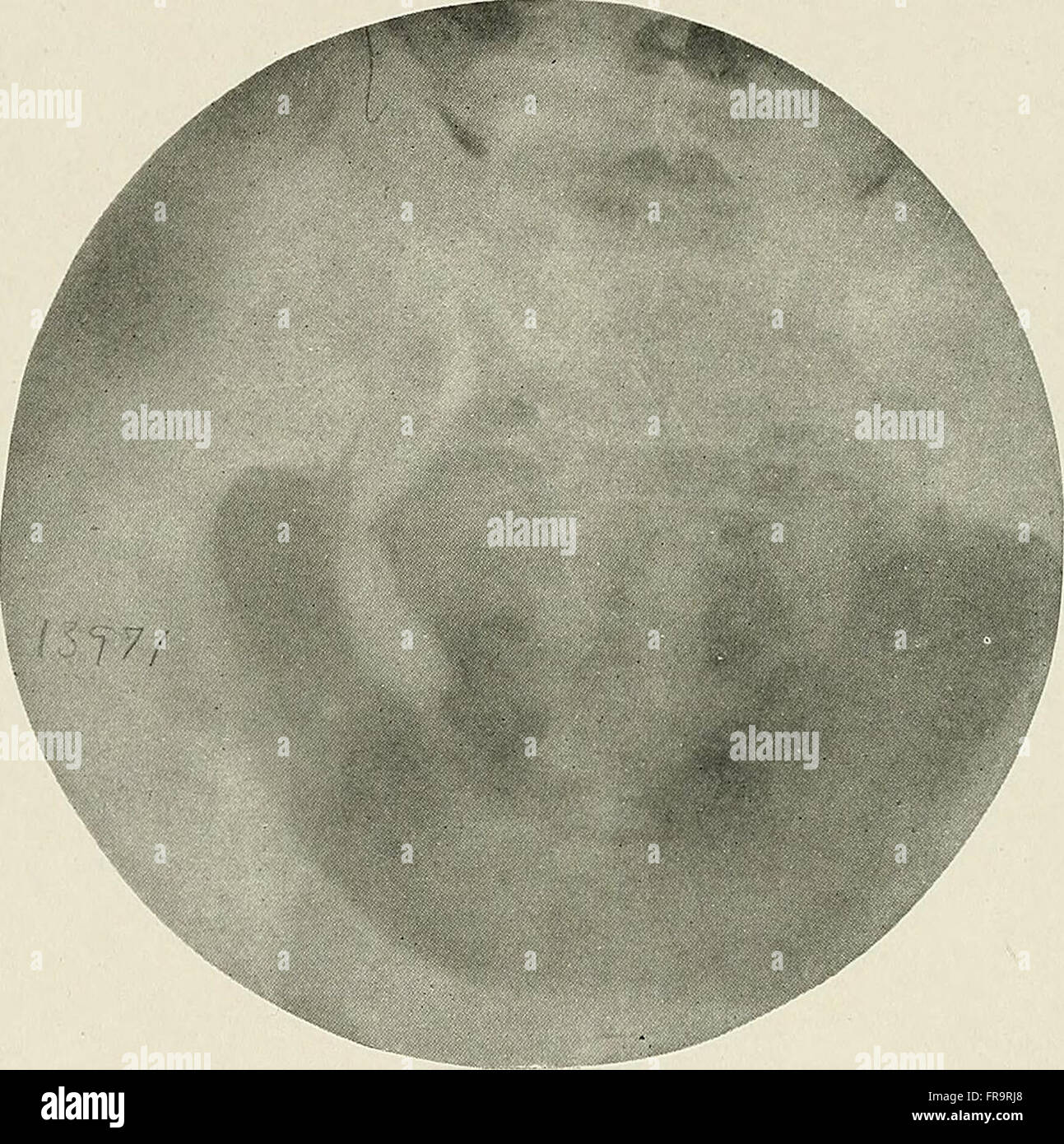 Pyelography (pyelo-ureterography) a study of the normal and pathologic ...