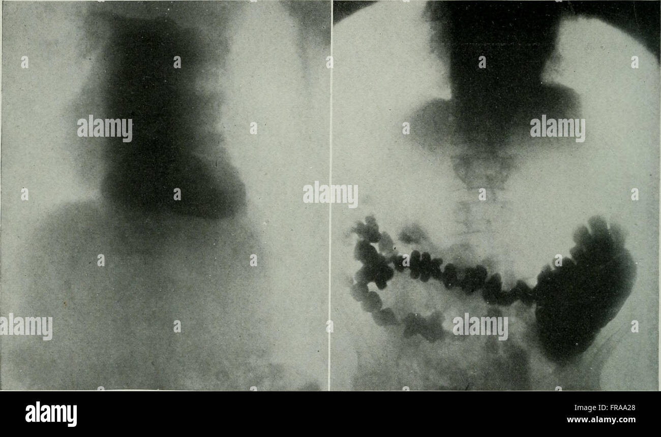 'The American Journal of Roentgenology, Radium Therapy, and Nuclear ...