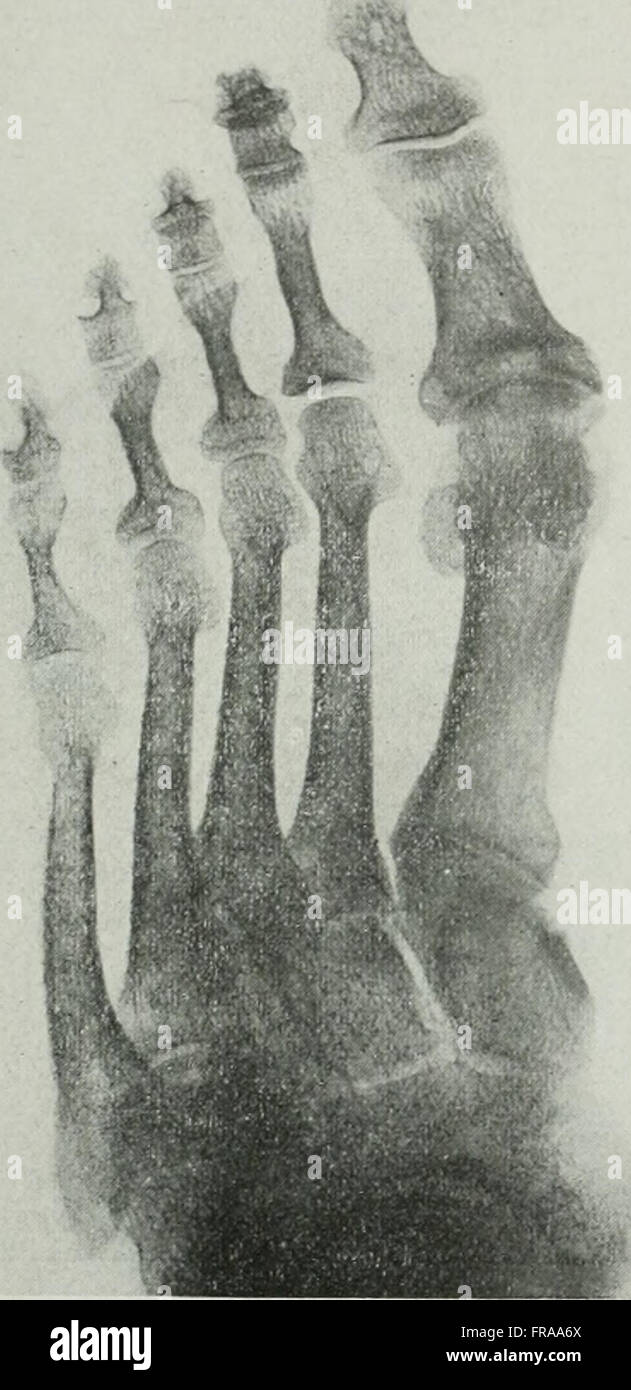 The American Journal of Roentgenology, Radium Therapy, and Nuclear ...