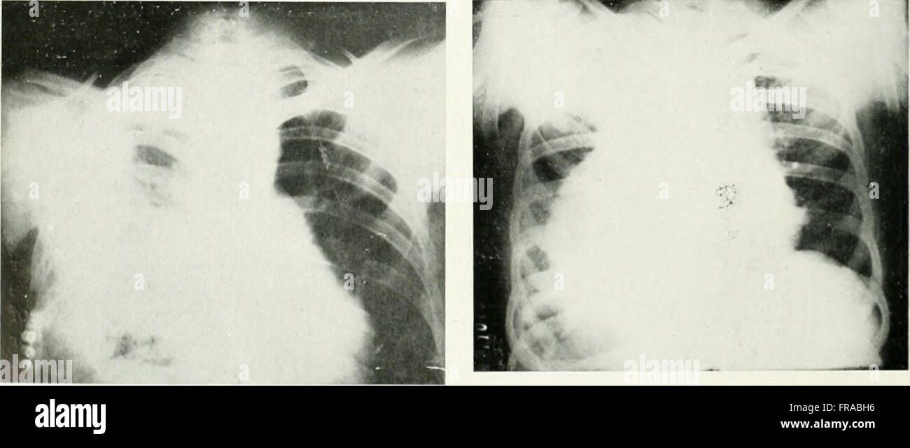 The American journal of roentgenology, radium therapy and nuclear ...