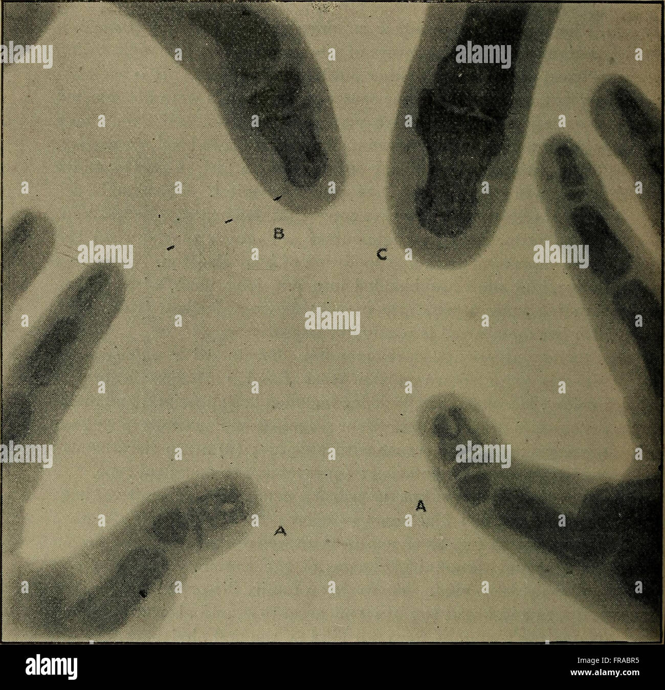 This 1899 illustration showcases the early use of X-rays in medical ...