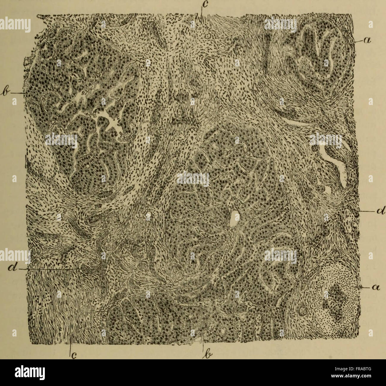 This 1895 work discusses the fundamentals of pathological histology ...