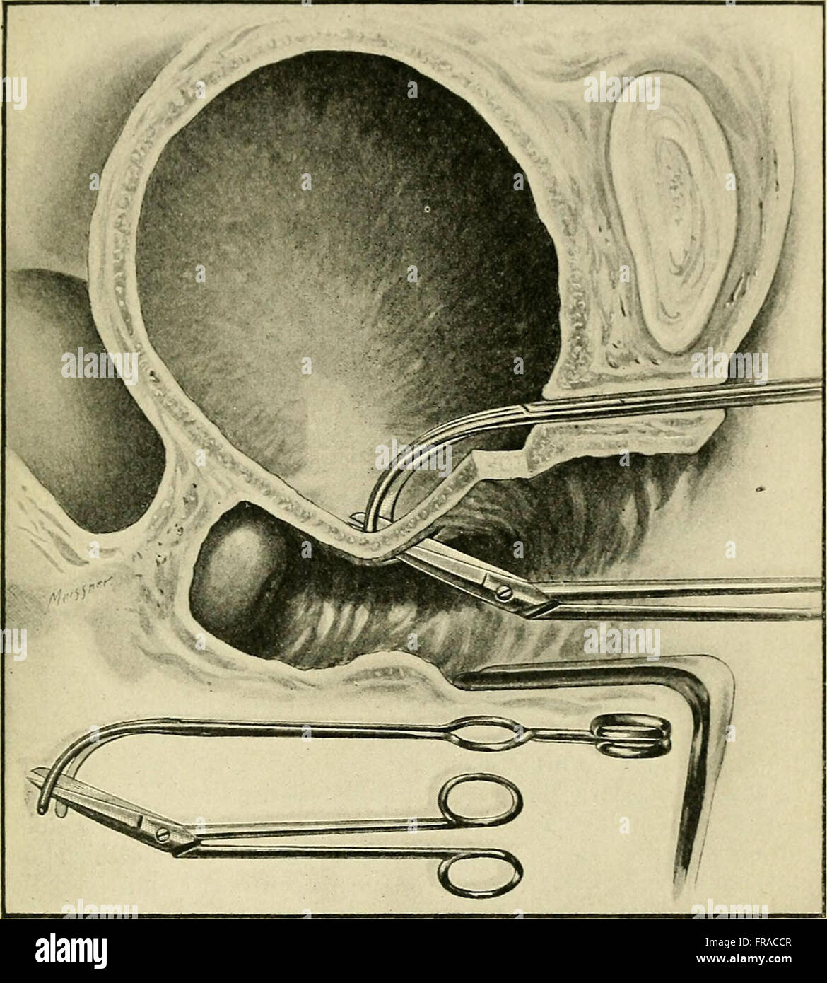 This 1904 text on gynecology provides a comprehensive guide for both ...