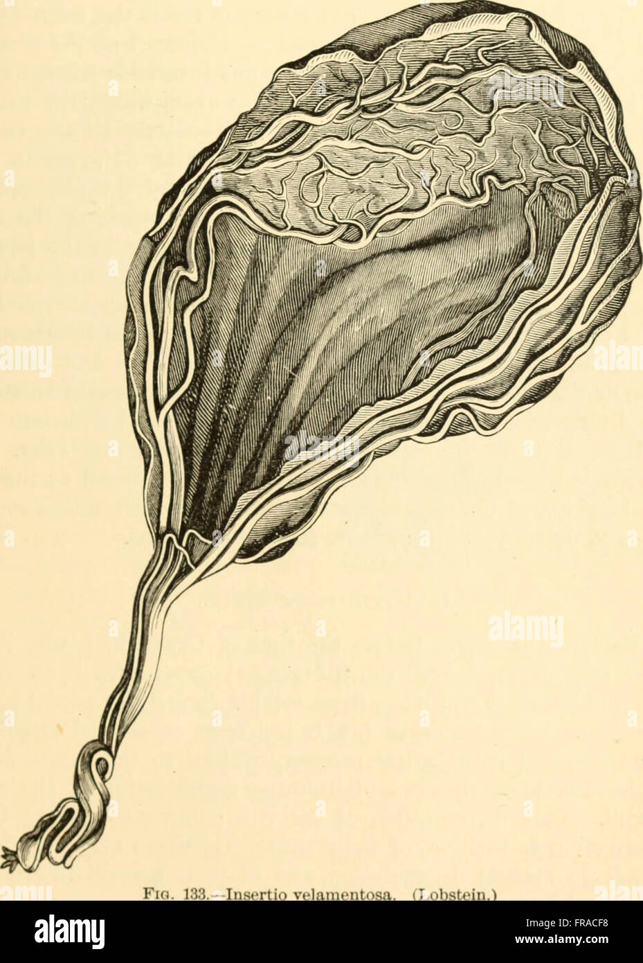 A 1897 text on the science and art of midwifery, discussing obstetric ...