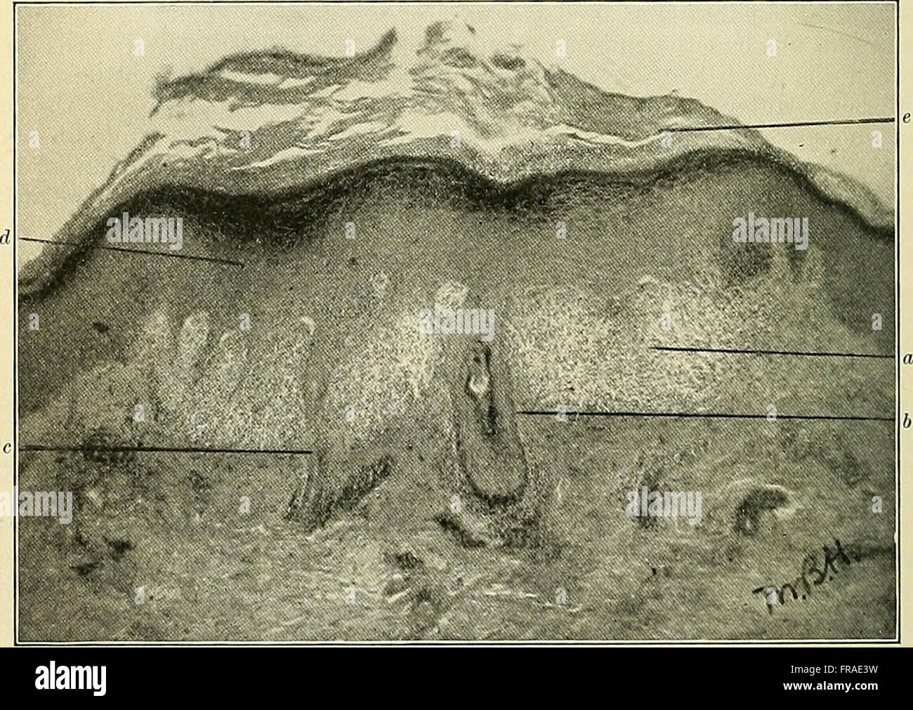 This medical textbook (1898) provides detailed information on genito ...