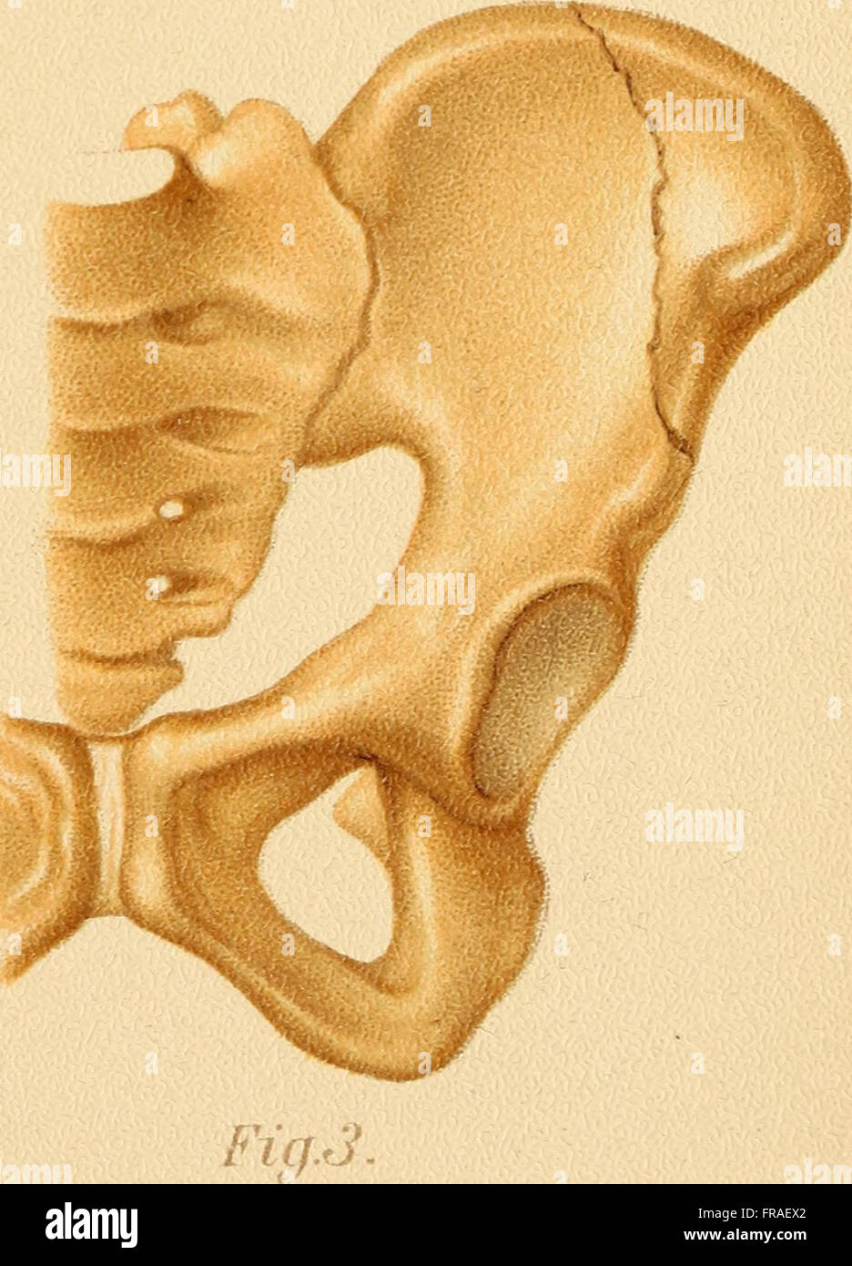 This 1902 atlas and epitome focuses on traumatic injuries, providing ...