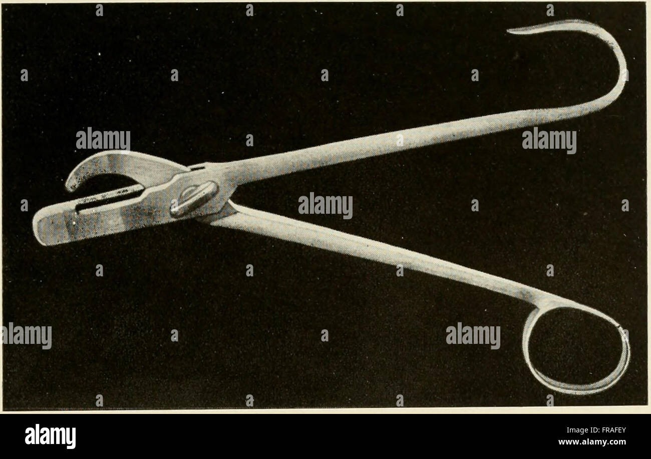 This 1914 book offers a comprehensive guide to animal castration ...
