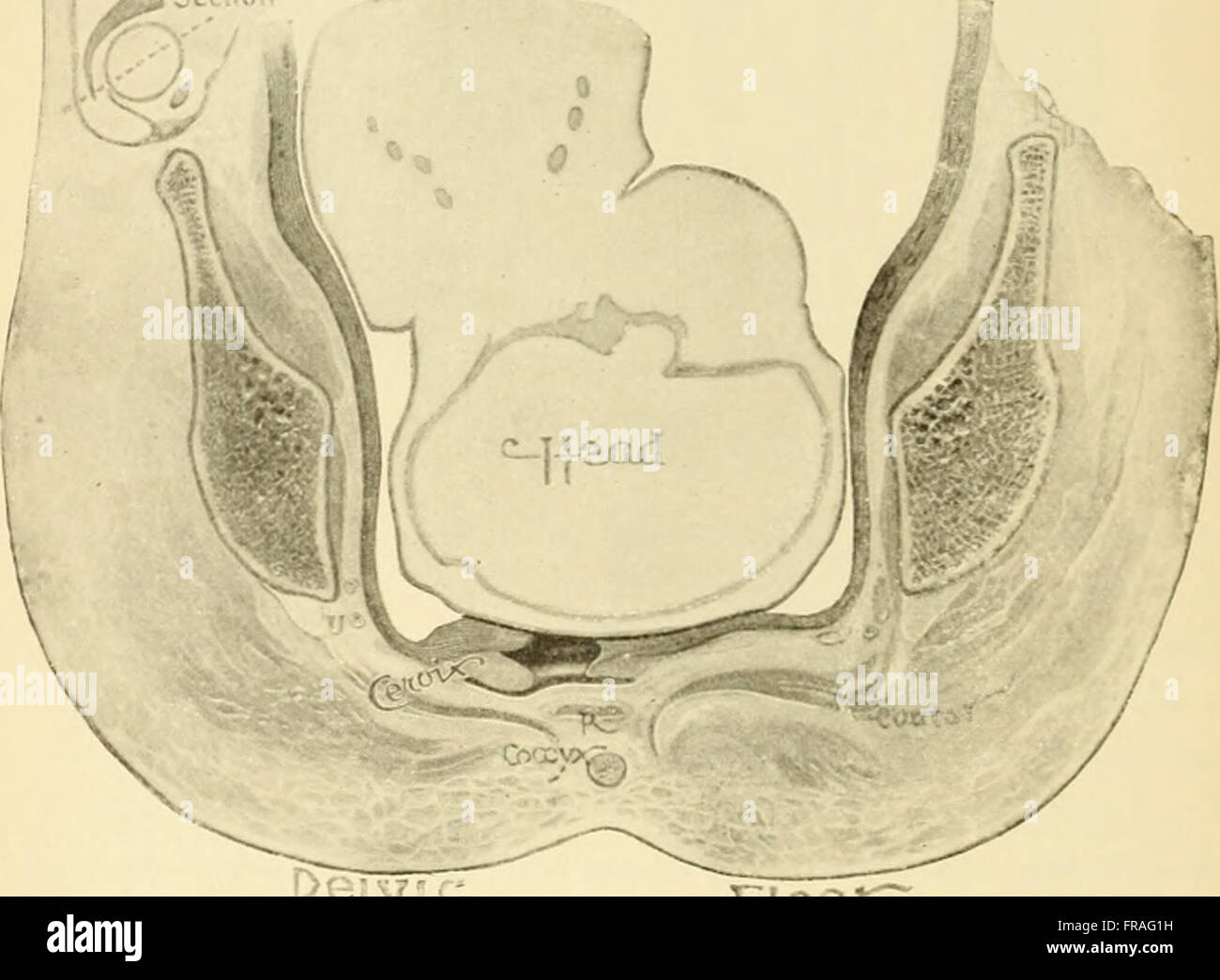 This textbook on obstetrics (1897) offers comprehensive guidance for ...