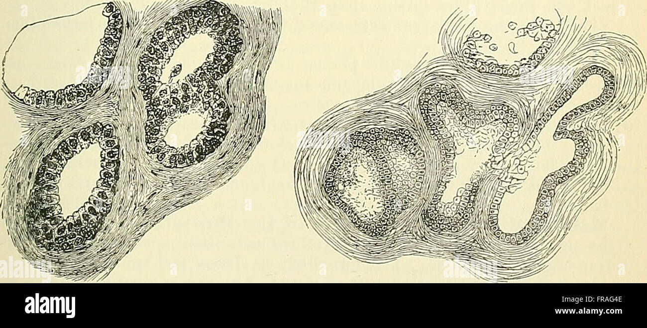 An American text-book of genito-urinary diseases, syphilis and diseases ...