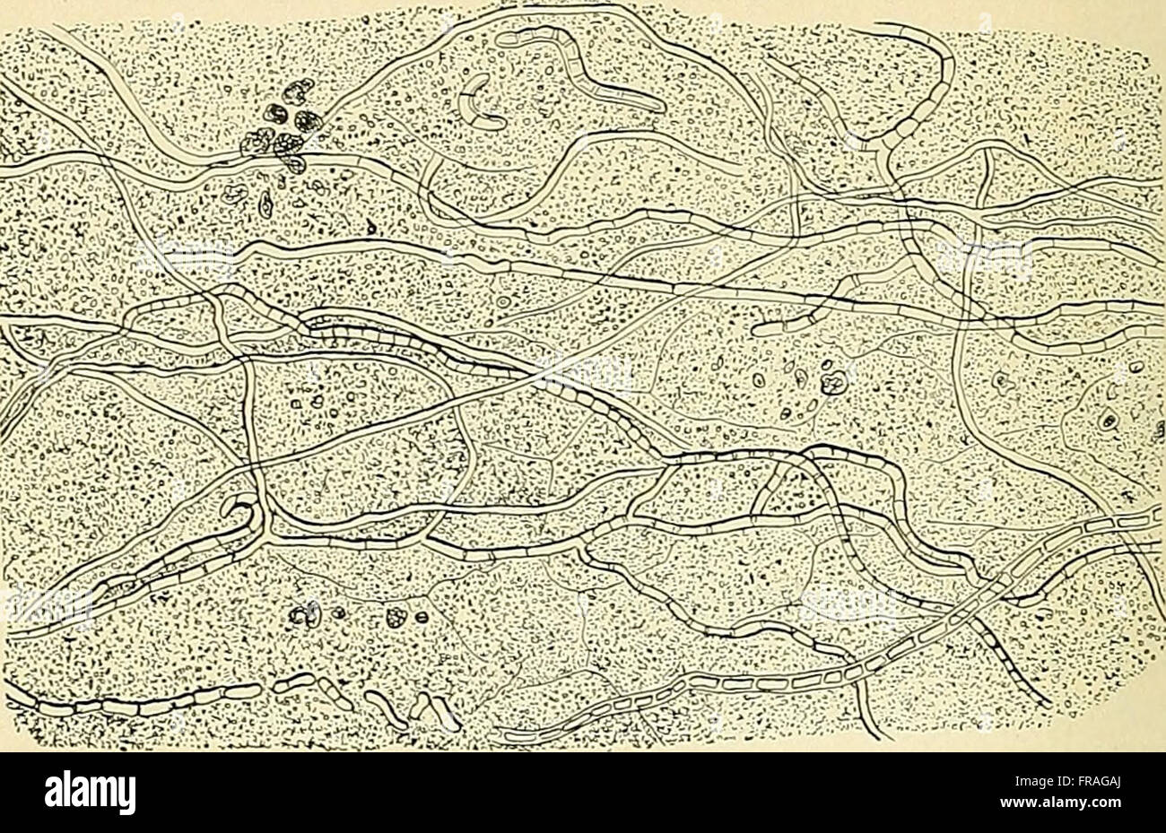 This 1898 textbook covers genito-urinary diseases, syphilis, and skin ...