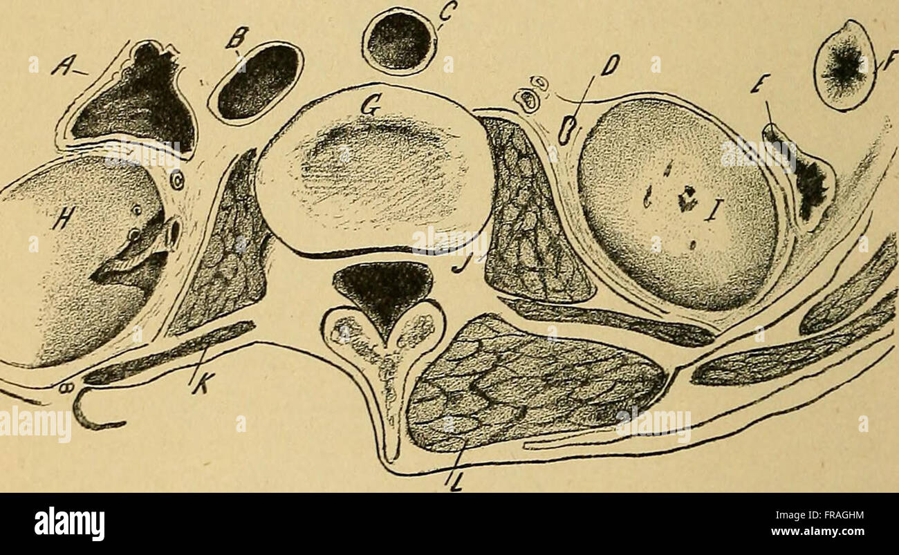 This 1893 medical work discusses the diagnosis, treatment, and ...