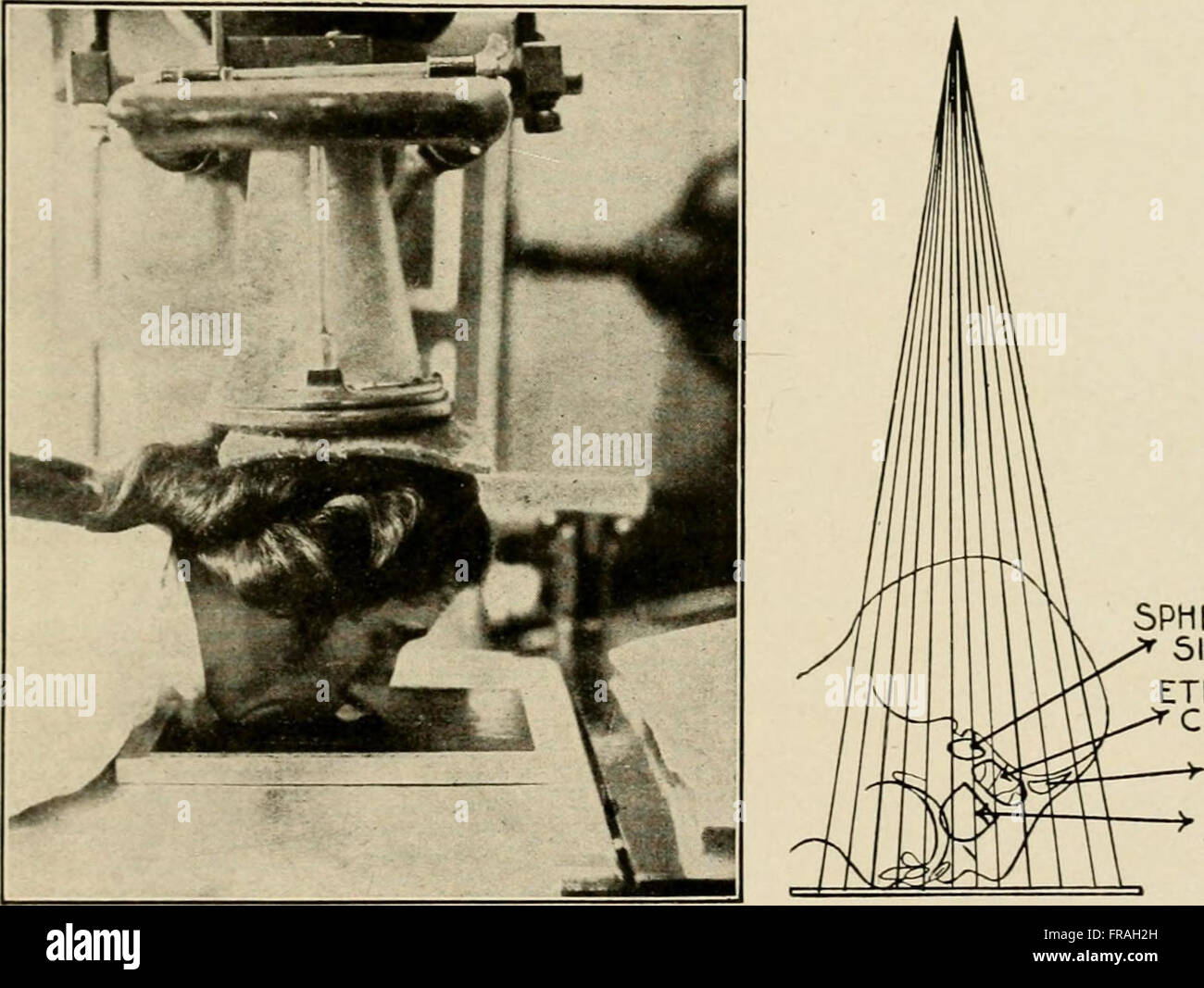 Elementary and dental radiography by howard riley raper 1918 hi-res ...
