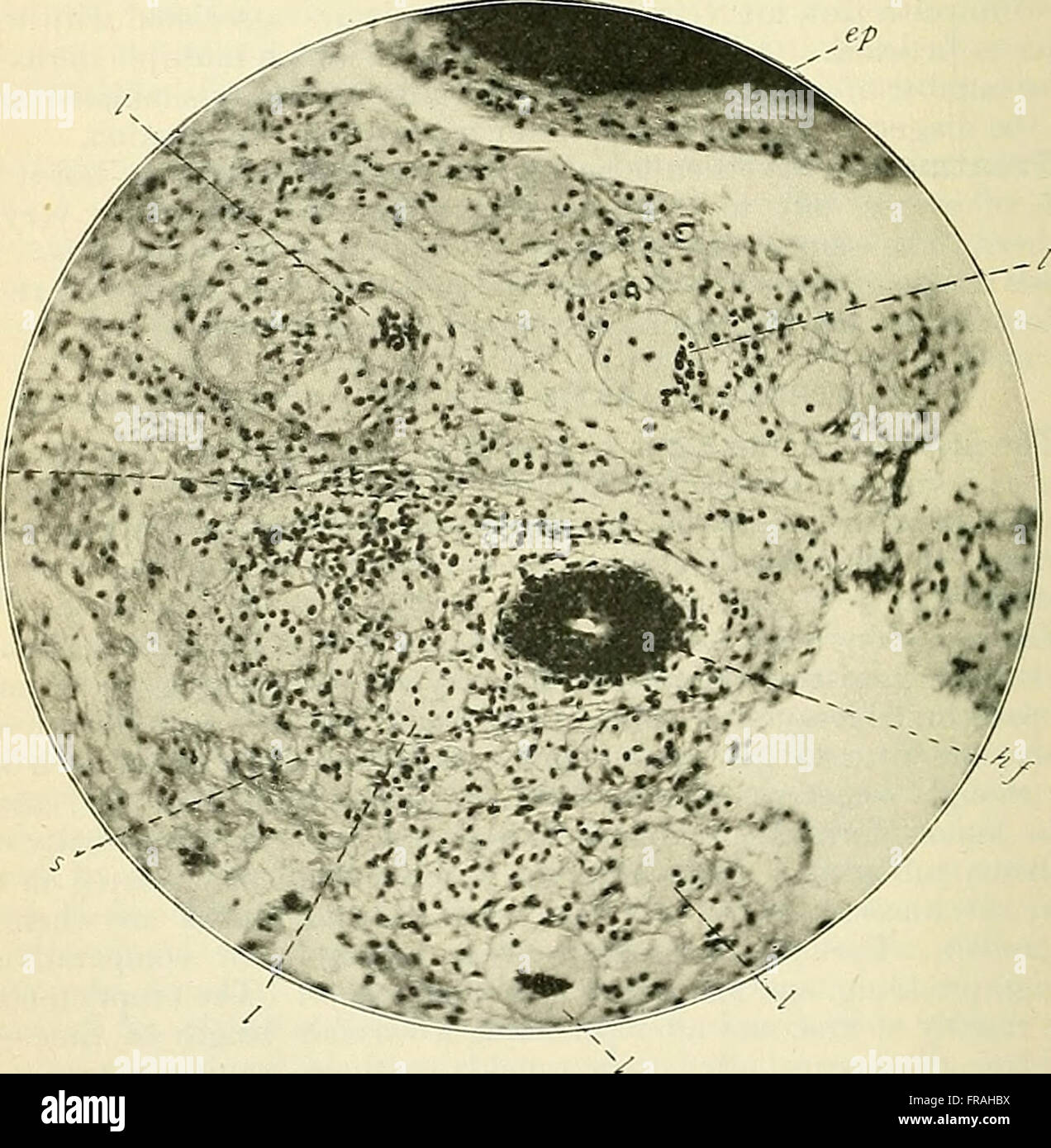 'An American Text-Book of Genito-Urinary Diseases' (1898) is a medical ...