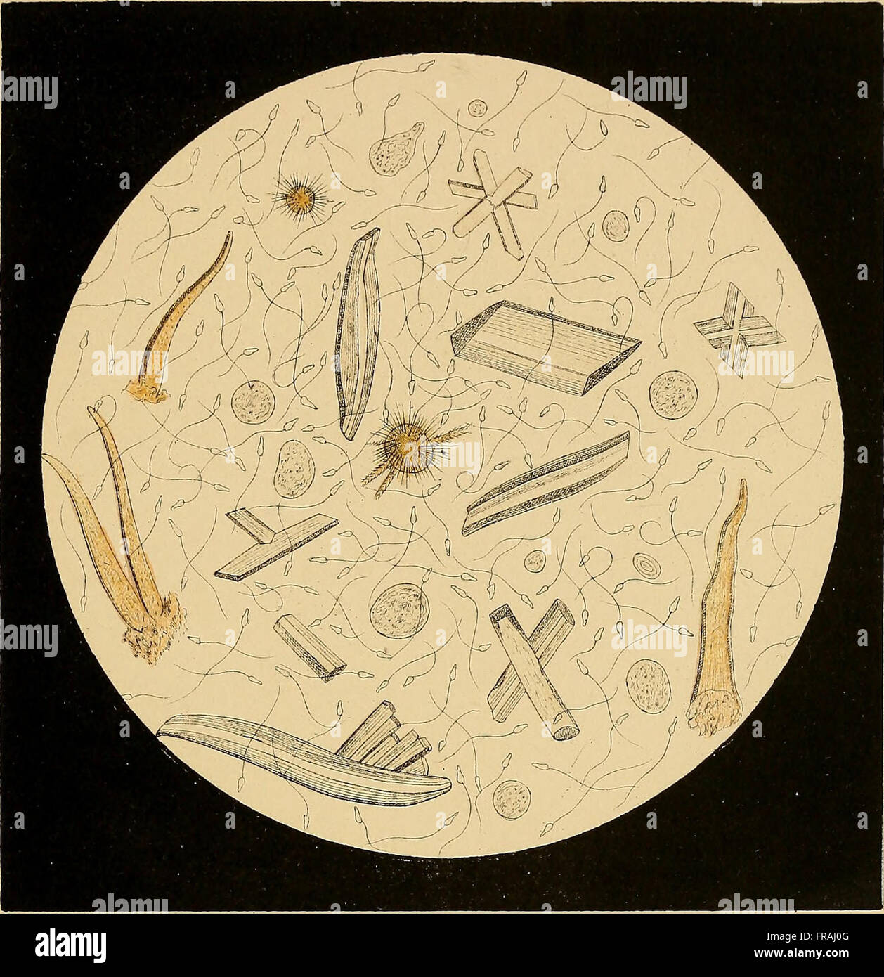 An 1885 atlas illustrating clinical microscopy techniques, featuring ...