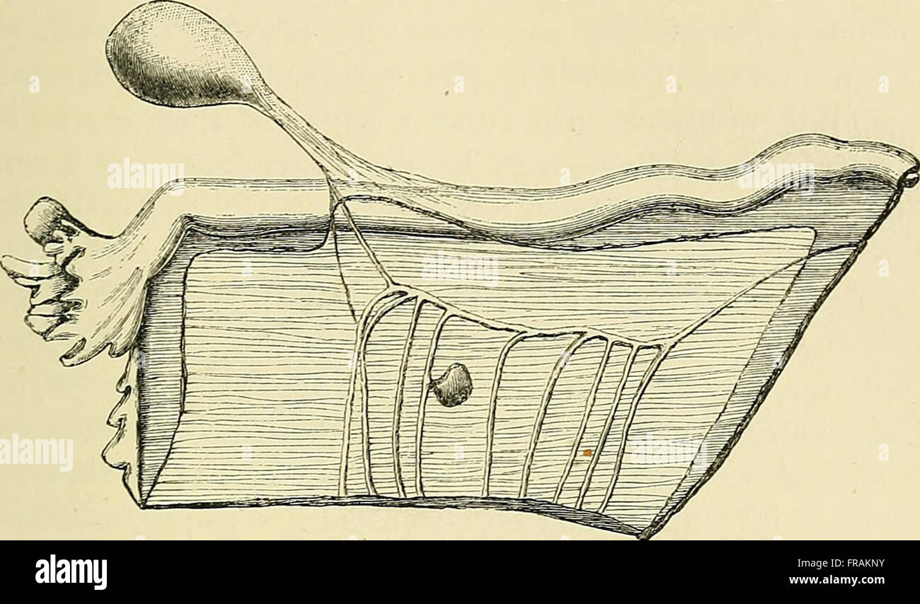 Clinical and pathological observations on tumours of the ovary ...