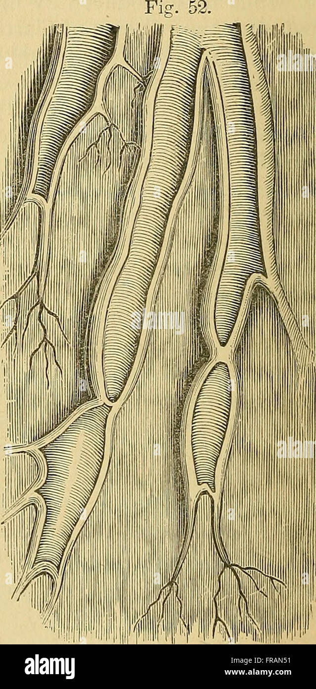 Elements of Pathological Anatomy (1843) explores the structural changes ...