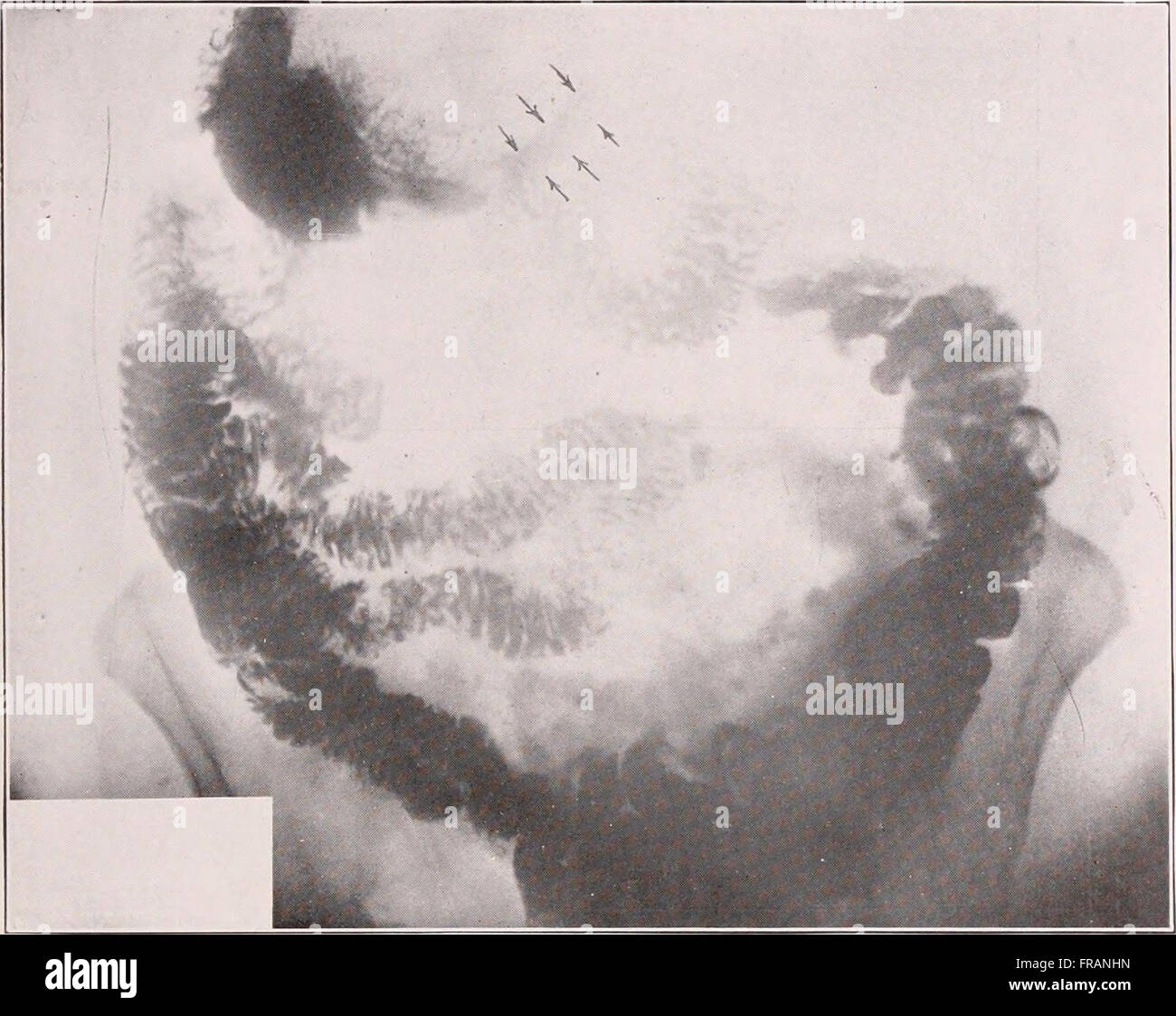 The 1919 Journal of Roentgenology explores advancements in X-ray ...