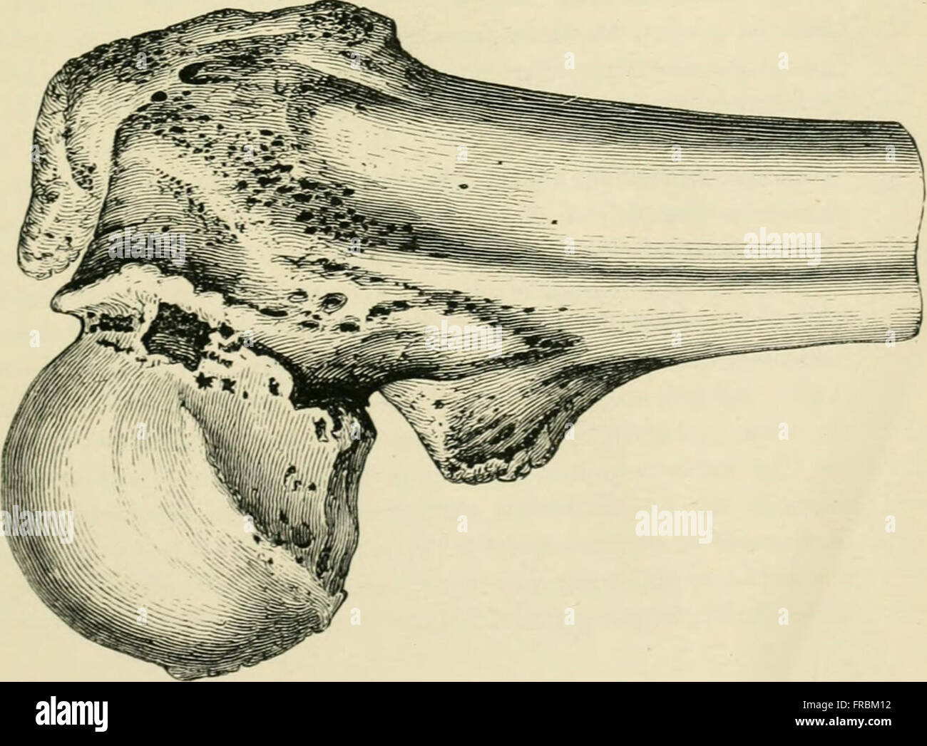 Irish medical history hi-res stock photography and images - Alamy