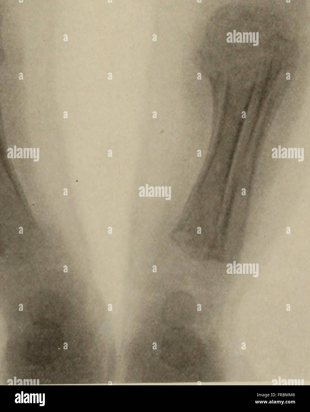 This 1910 work on living anatomy and pathology explores the structures ...