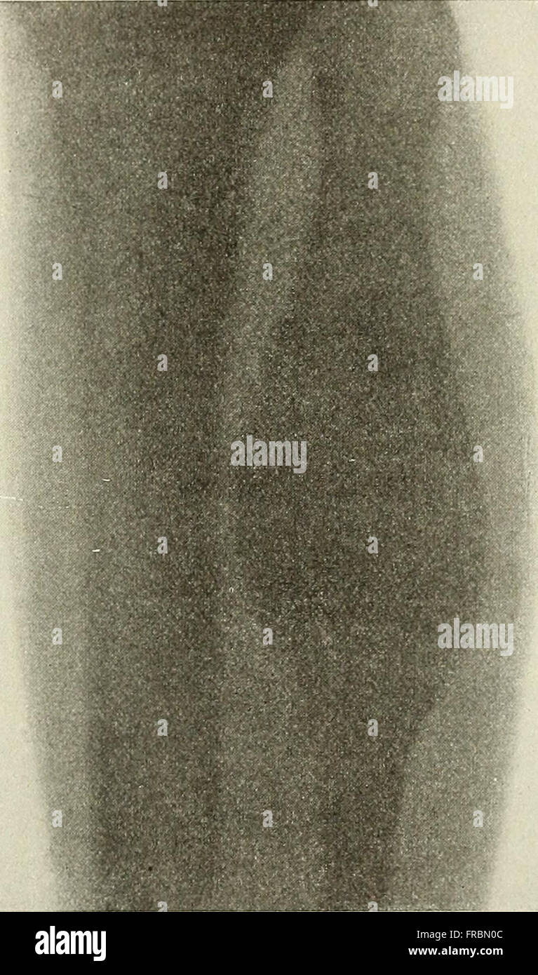 Modern surgery, general and operative (1914 Stock Photo - Alamy