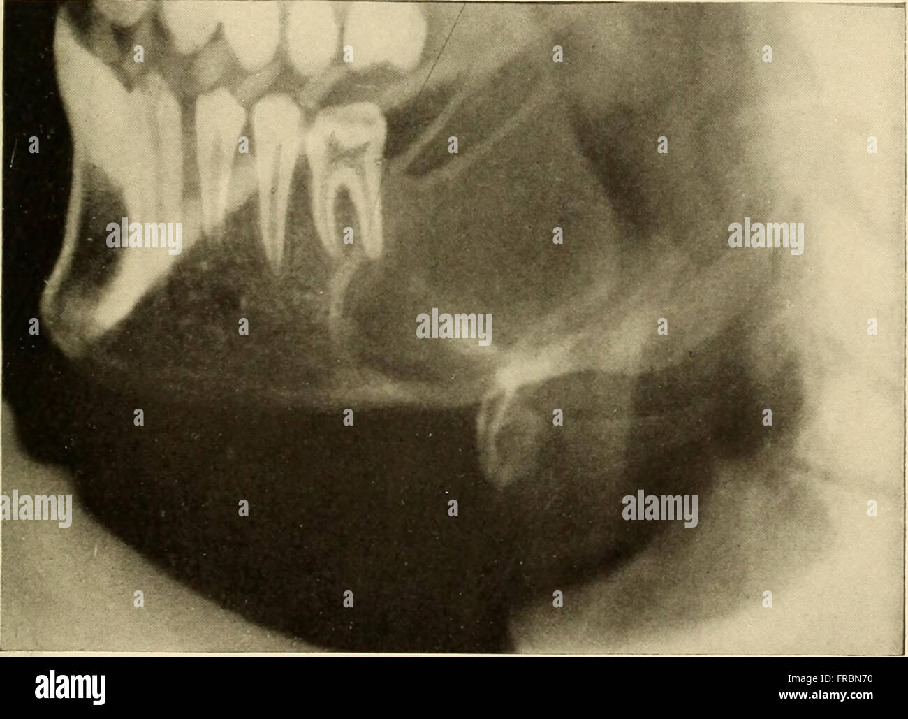 Oral Roentgenology - a Roentgen study of the anatomy and pathology of ...