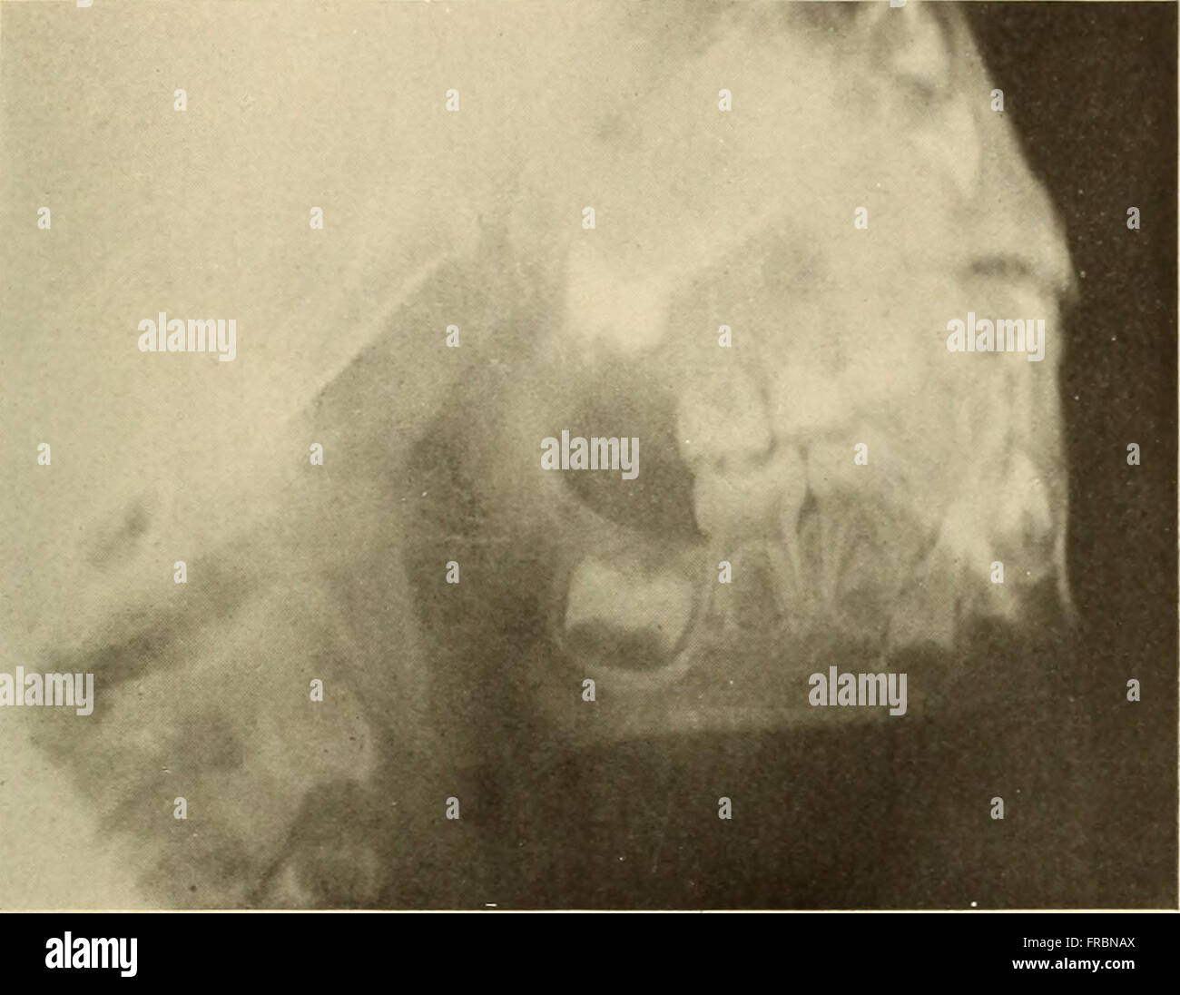 This work focuses on the application of Roentgen (X-ray) technology to ...