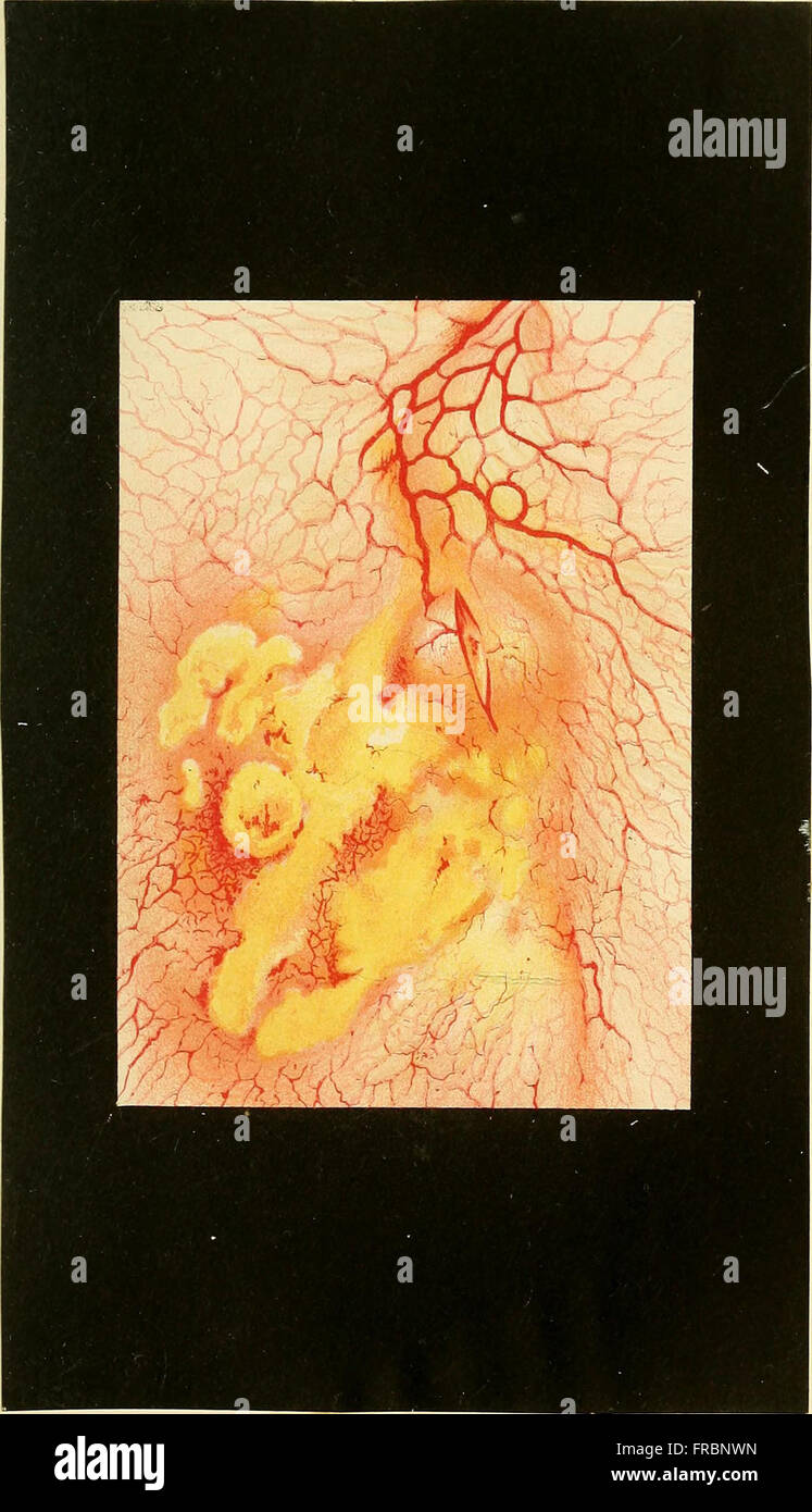 This 1870 work on epilepsy presents a detailed examination of the ...