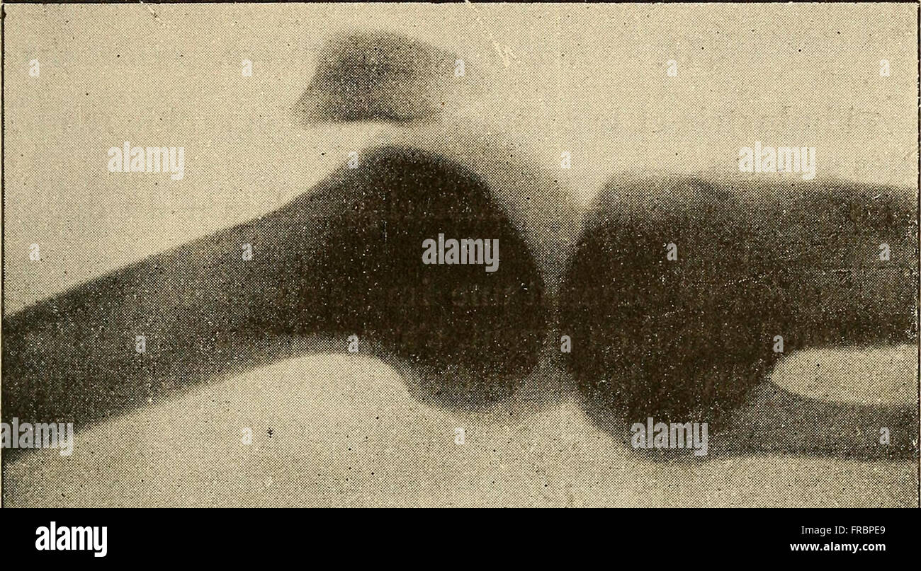 Radiographie de diagnostic hi-res stock photography and images - Alamy